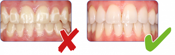 Meer informatie over de Poetsfolder